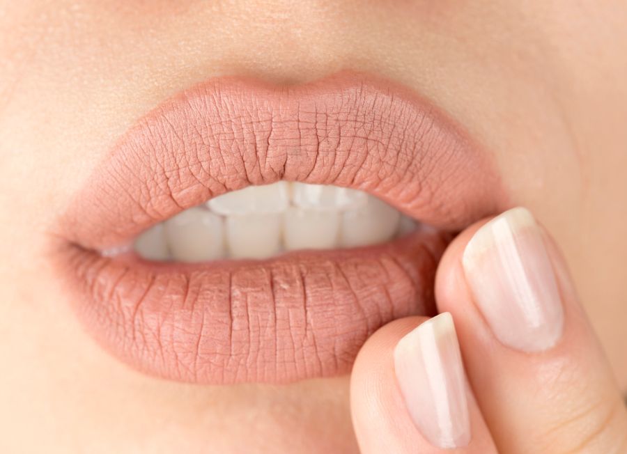 Coldsores - Triggers and Treatments